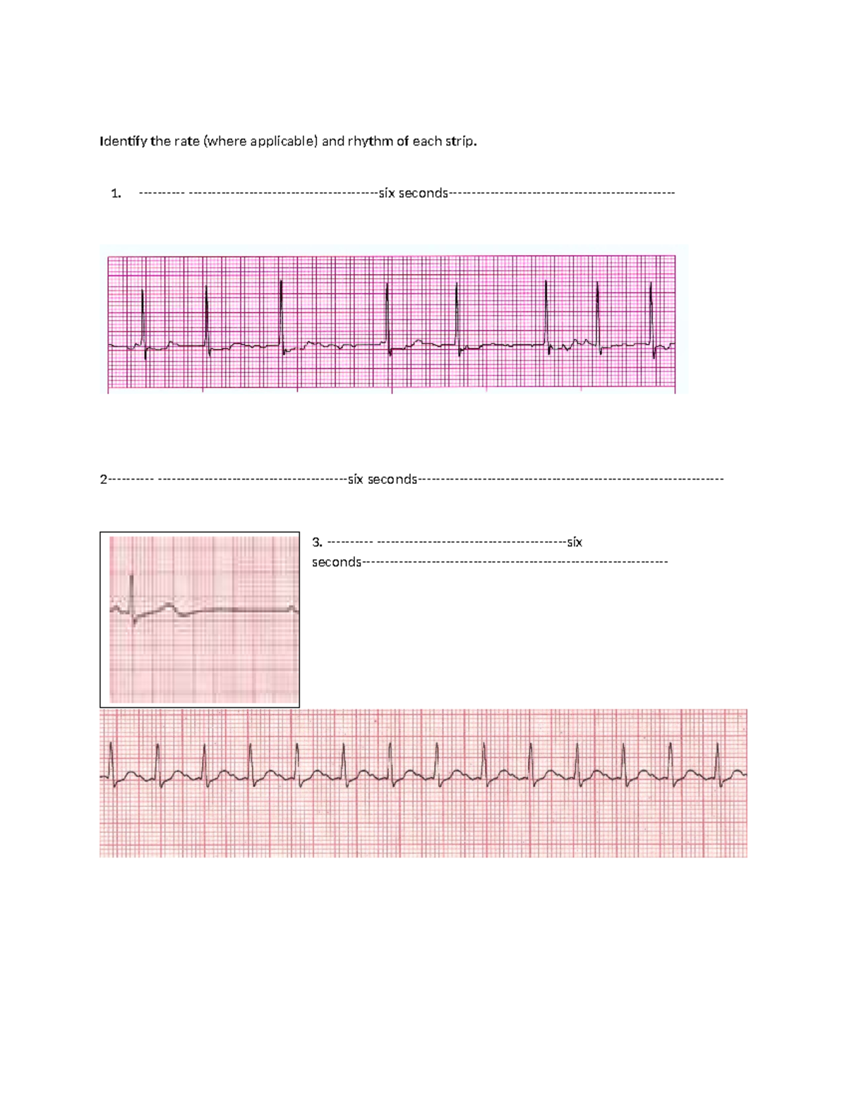Ekg rhythm interpretation - Identify the rate (where applicable) and ...