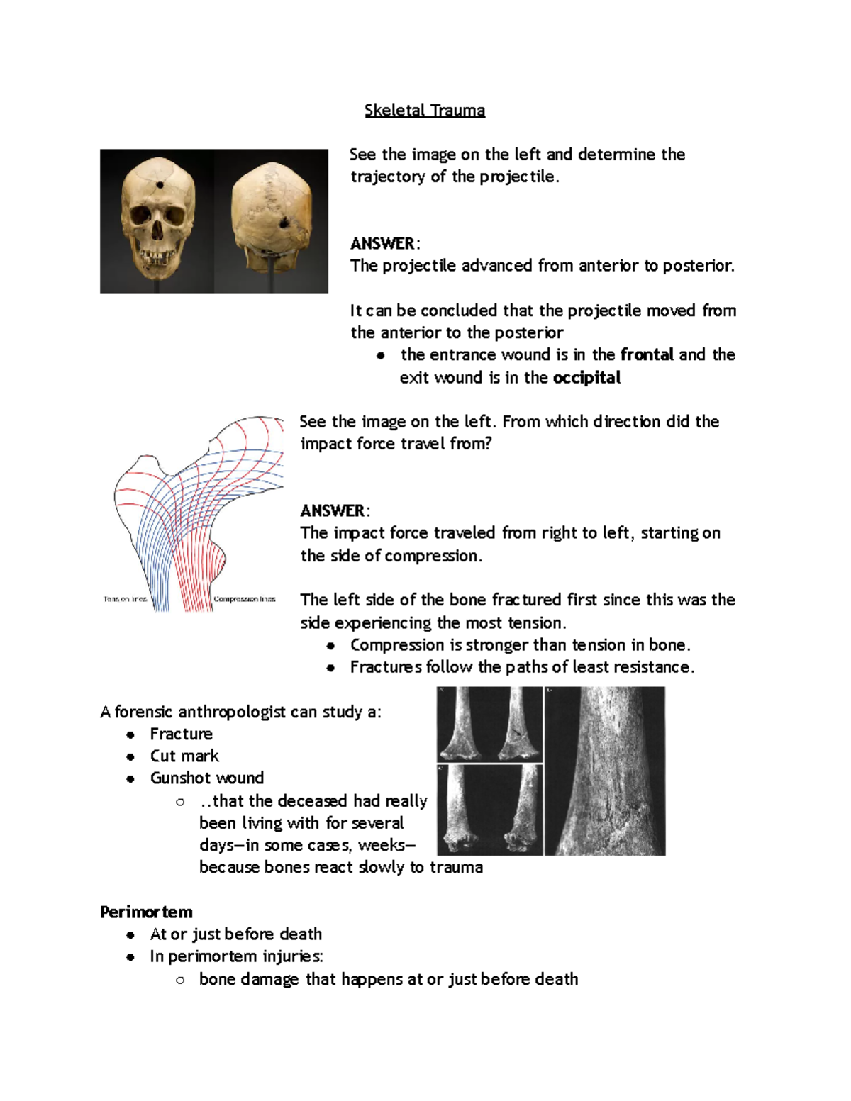 Skeletal Trauma - Forensic Anthropology - Skeletal Trauma See the image ...