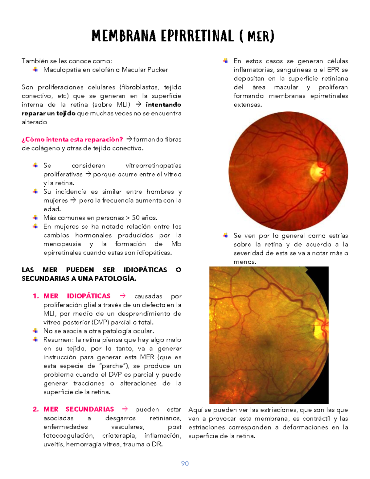 10. Membrana Epirretinal (MER) - También se les conoce como ...