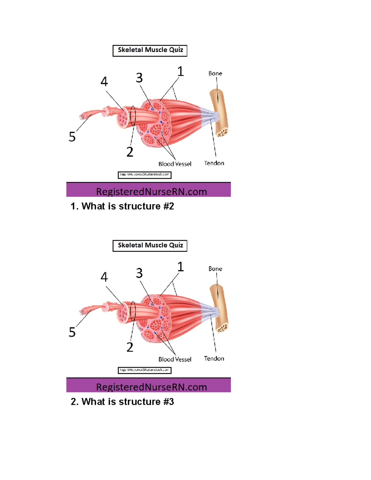 2a histo moving - What is structure # What is structure # What is structure # 4. What is ...