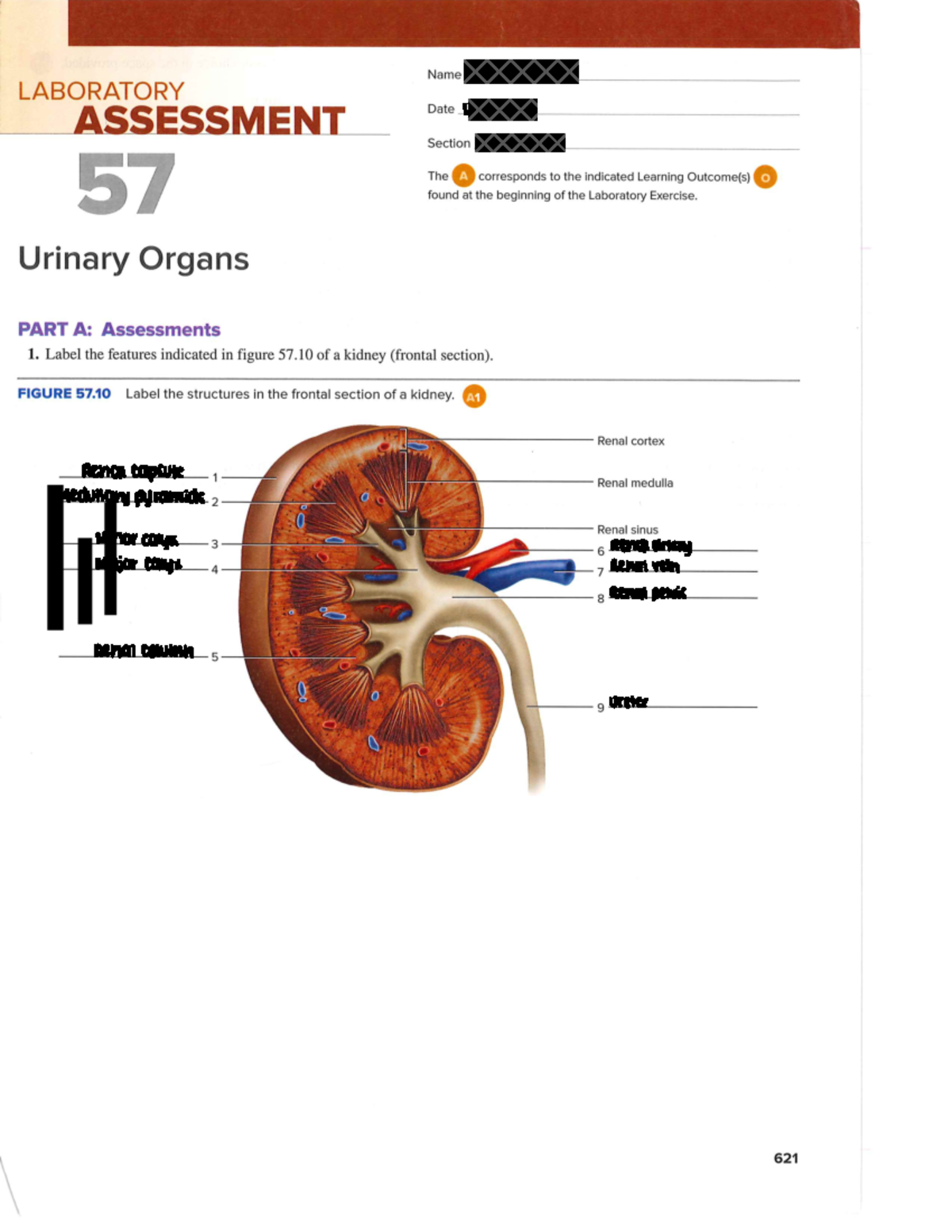 Lab Assessment 57 - SHSP-304 - 1 Renal capsule Medullary pyramids Minor ...