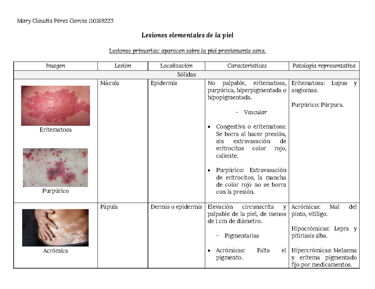 Lesiones Elementales - Dra Natalia Tinoco - Lesiones elementales de la ...