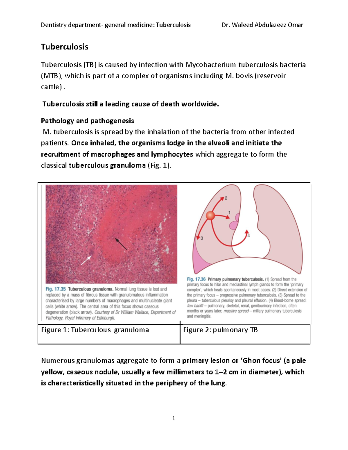 15- Tuberculosis - General pathology - Tuberculosis Tuberculosis (TB ...