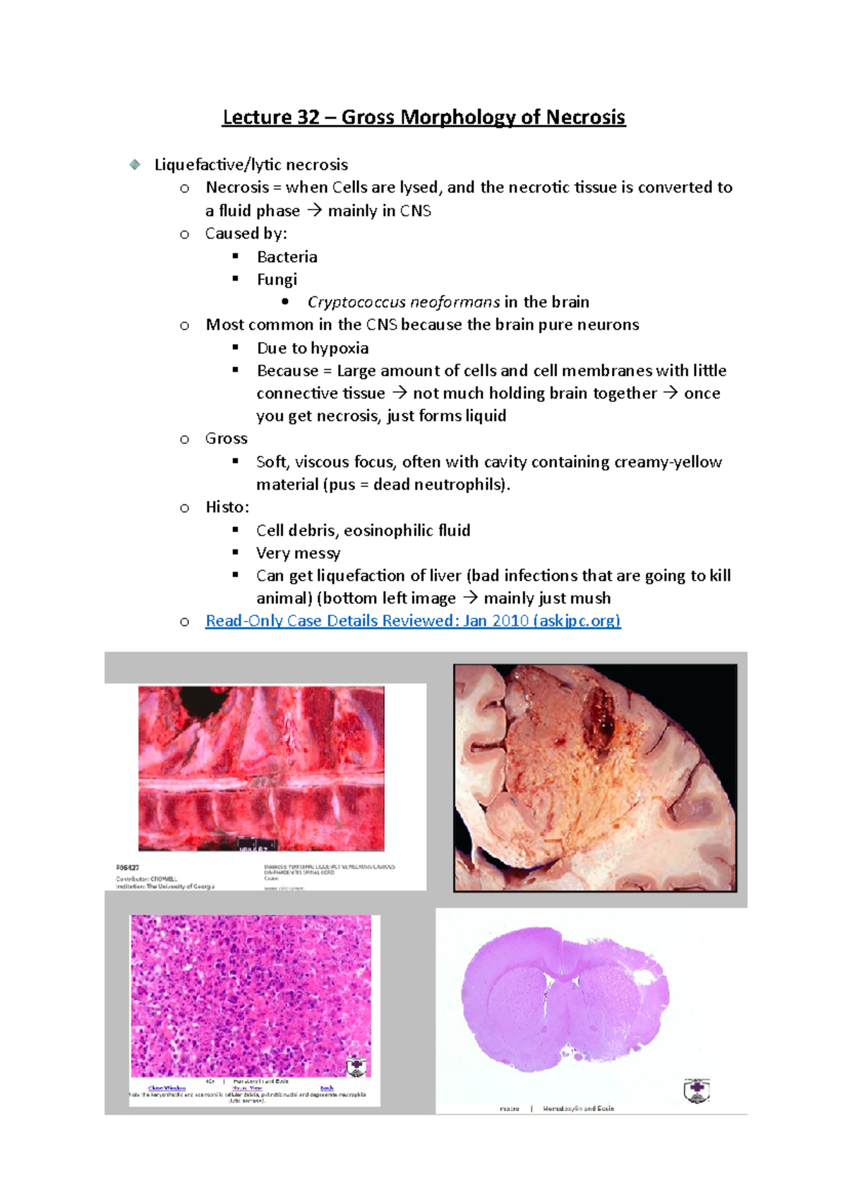 Lecture 32 – Gross Morphology of Necrosis - Lecture 32 – Gross ...