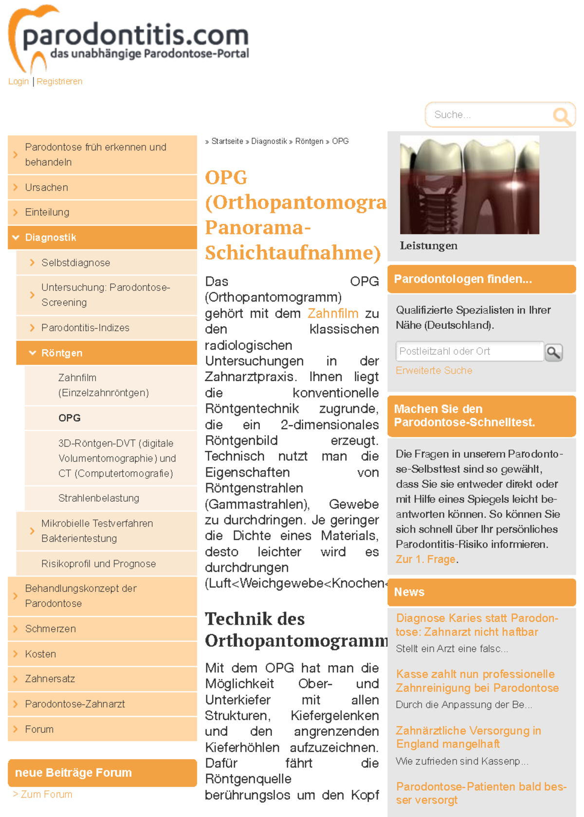 OPG (Orthopantomogramm, Panorama-Schichtaufnahme) - Parodontose früh ...