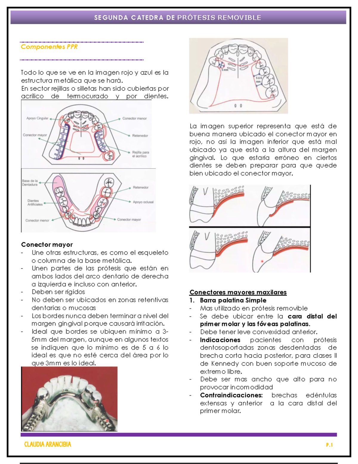 Protesis Removible II - Catedra 2 - Componentes PPR Todo lo que se ve ...