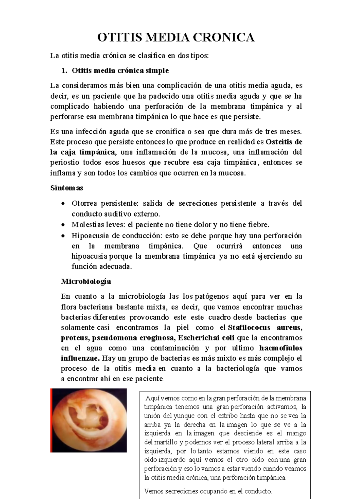Otitis Media Cronica - montas - OTITIS MEDIA CRONICA La otitis media ...