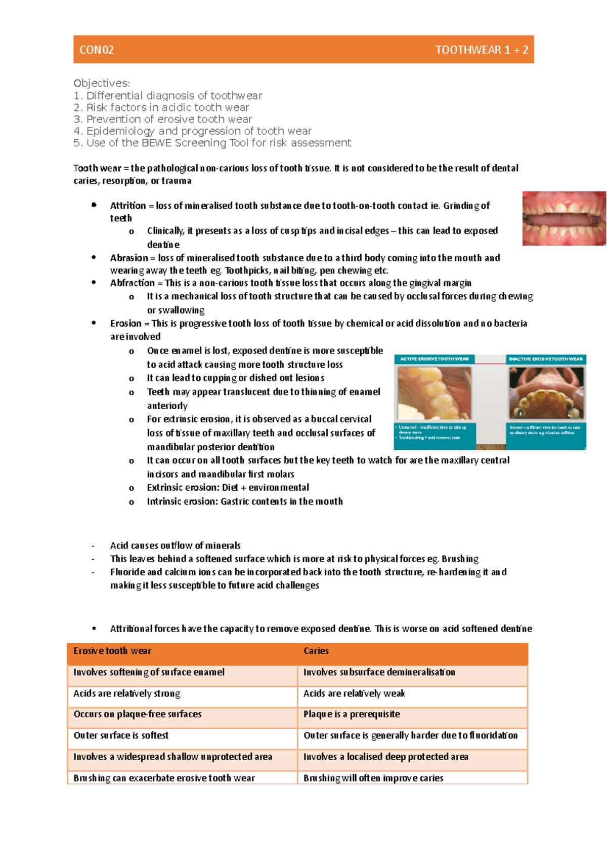 Tooth wear notes - CON02 TOOTHWEAR 1 + 2 Objectives: Differential ...