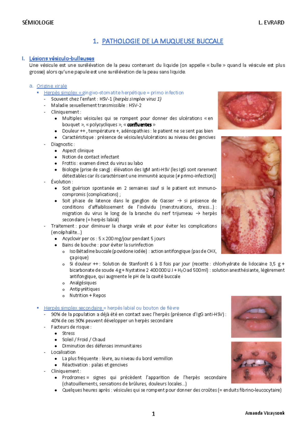 Semio Evrard - Ams - fini - 1. PATHOLOGIE DE LA MUQUEUSE BUCCALE I ...