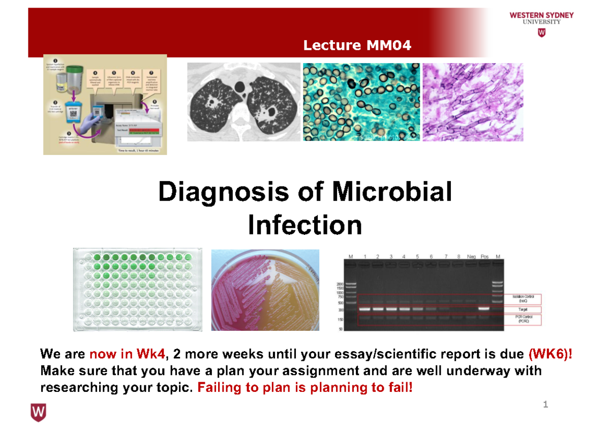 Lecture 4 Diagnosis of Infection ALL - Diagnosis of Microbial Infection ...