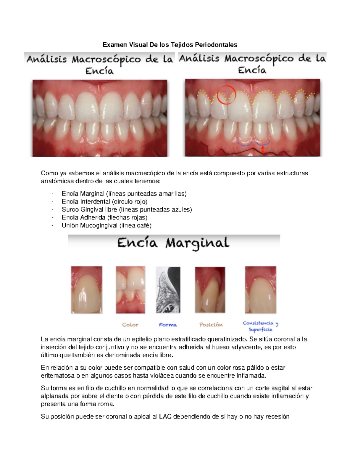 Examen Visual De los Tejidos Periodontales - Se sitúa coronal a la inserción del tejido ...