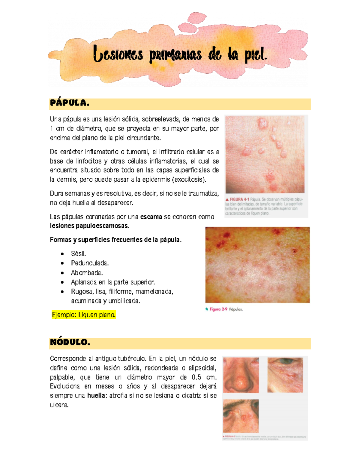 Lesiones primarias de la piel - P¡PULA. Una p·pula es una lesiÛn sÛlida ...