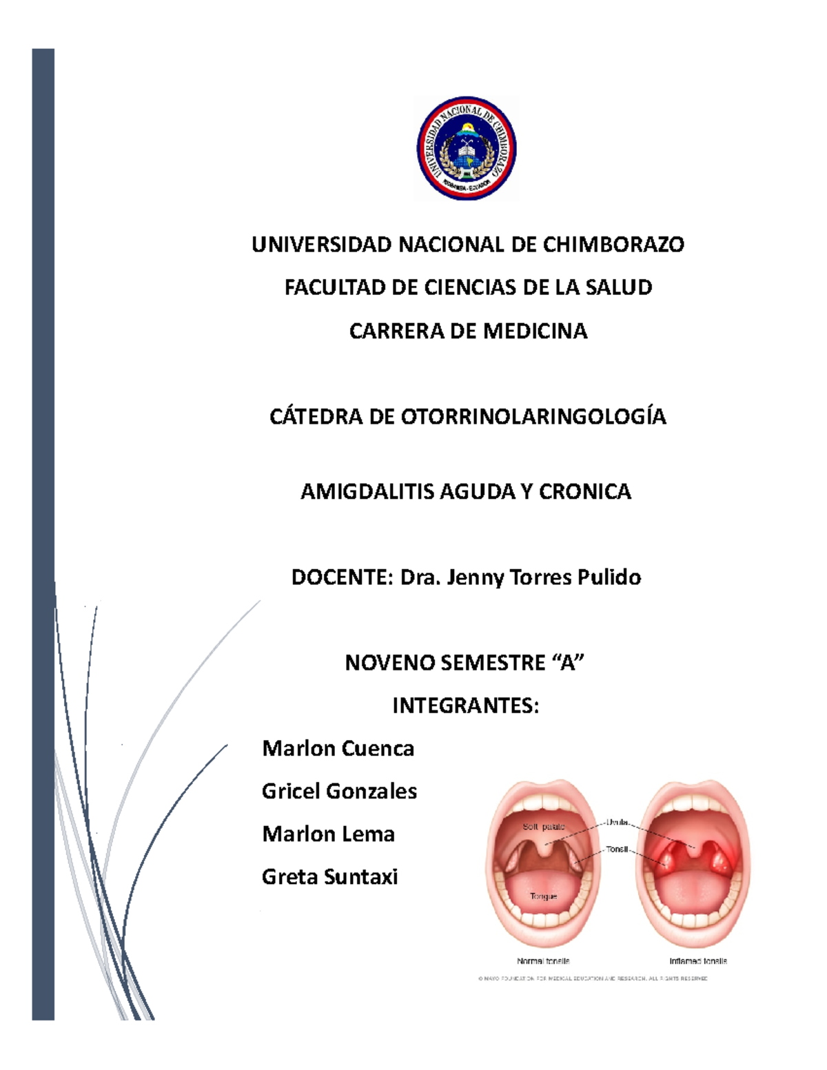 Amigdalitis Aguda Y Cronica - AMIGDALITIS AGUDA Y CRONICA DOCENTE: Dra ...