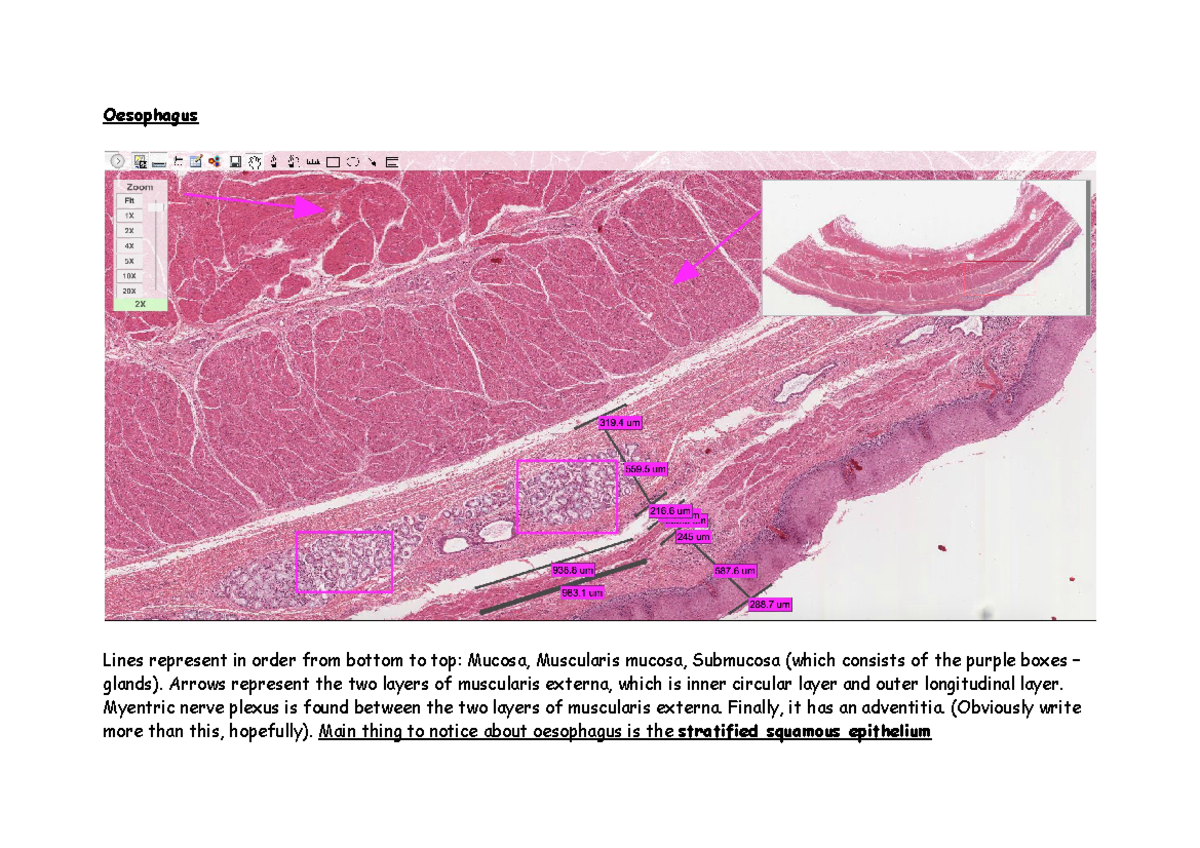 GIT Tissue diagnosis - Oesophagus Lines represent in order from bottom ...