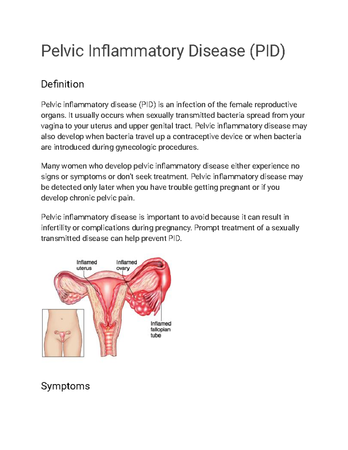 Pelvic Inflammatory Disease PID Pelvic Inflammatory 42 OFF