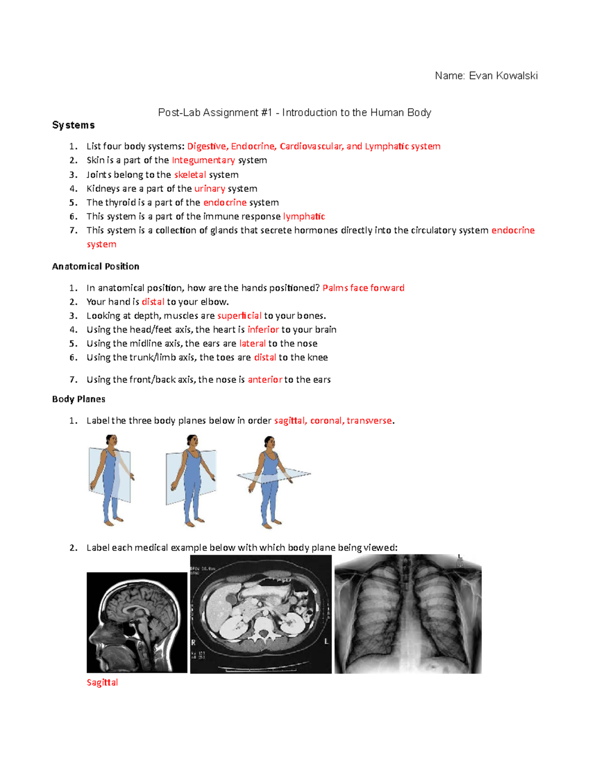 Body ORg Lab - Answers for body organization lab. Full points were ...