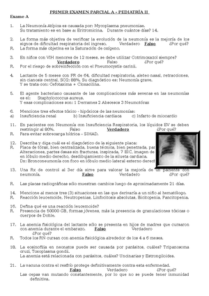 Macrognatia - crecimiento anormal de la mandicbula - Antes de estudiar ...