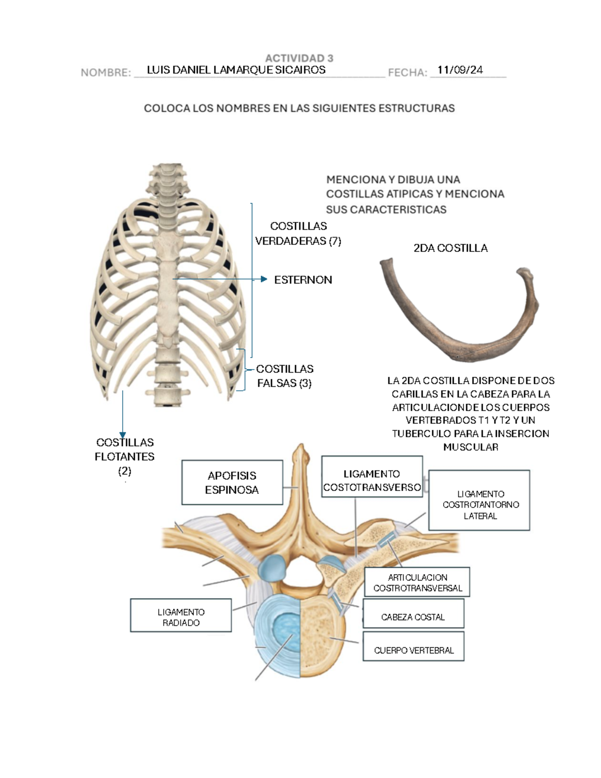 Anatomia de las costillas - APOFISIS ESPINOSA LIGAMENTO COSTOTRANSVERSO ...