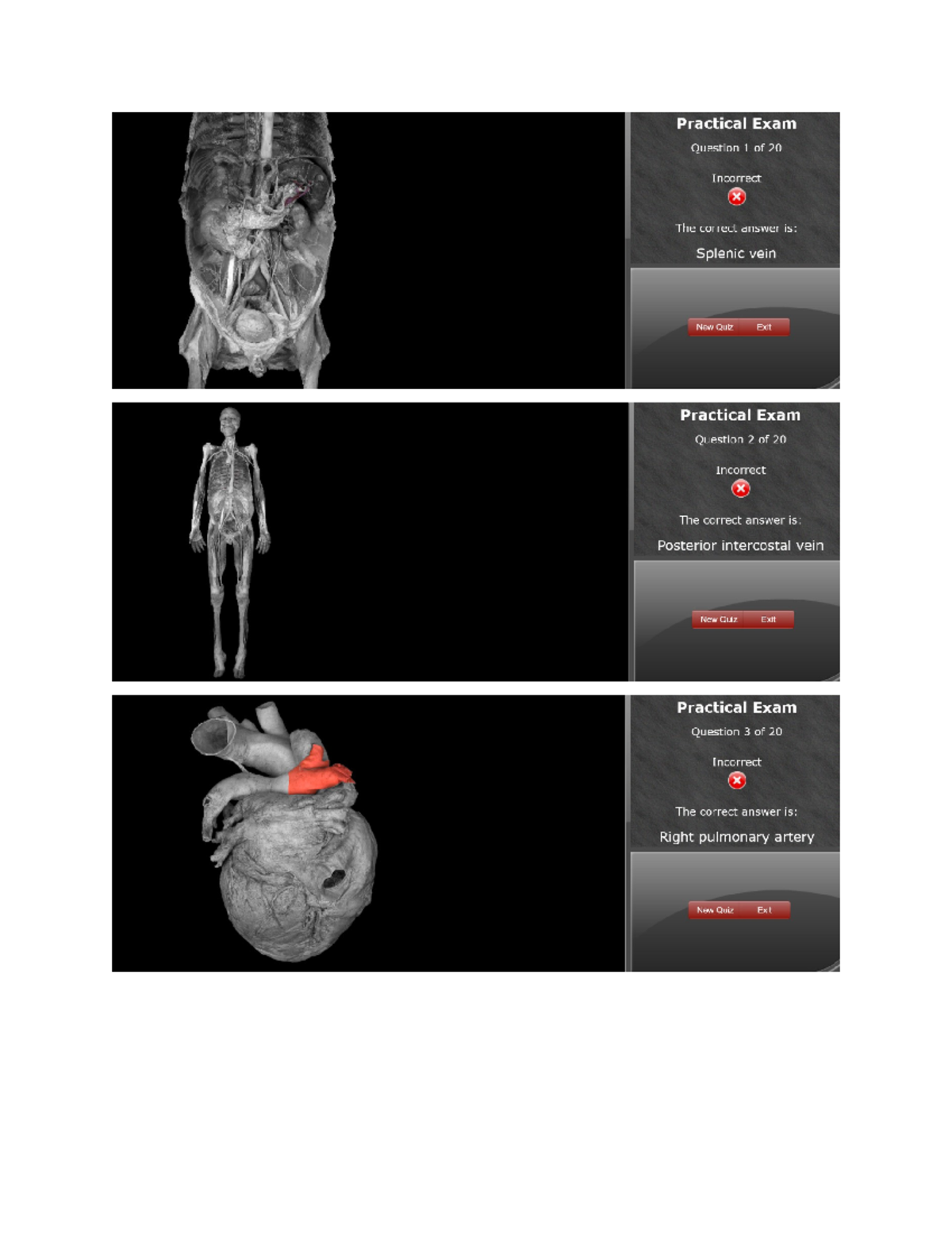 KIN262 Human anatomy Practical 6 - KIN 262 - Studocu