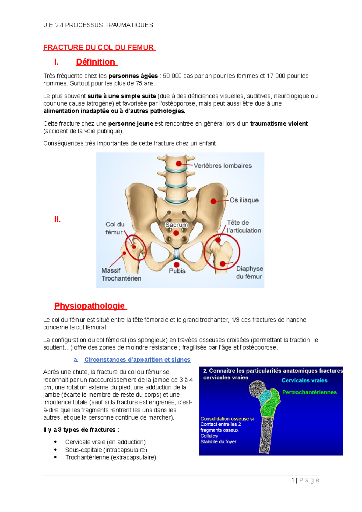 U.E 2.4 Fracture du col du fémur - U 2 PROCESSUS TRAUMATIQUES FRACTURE ...