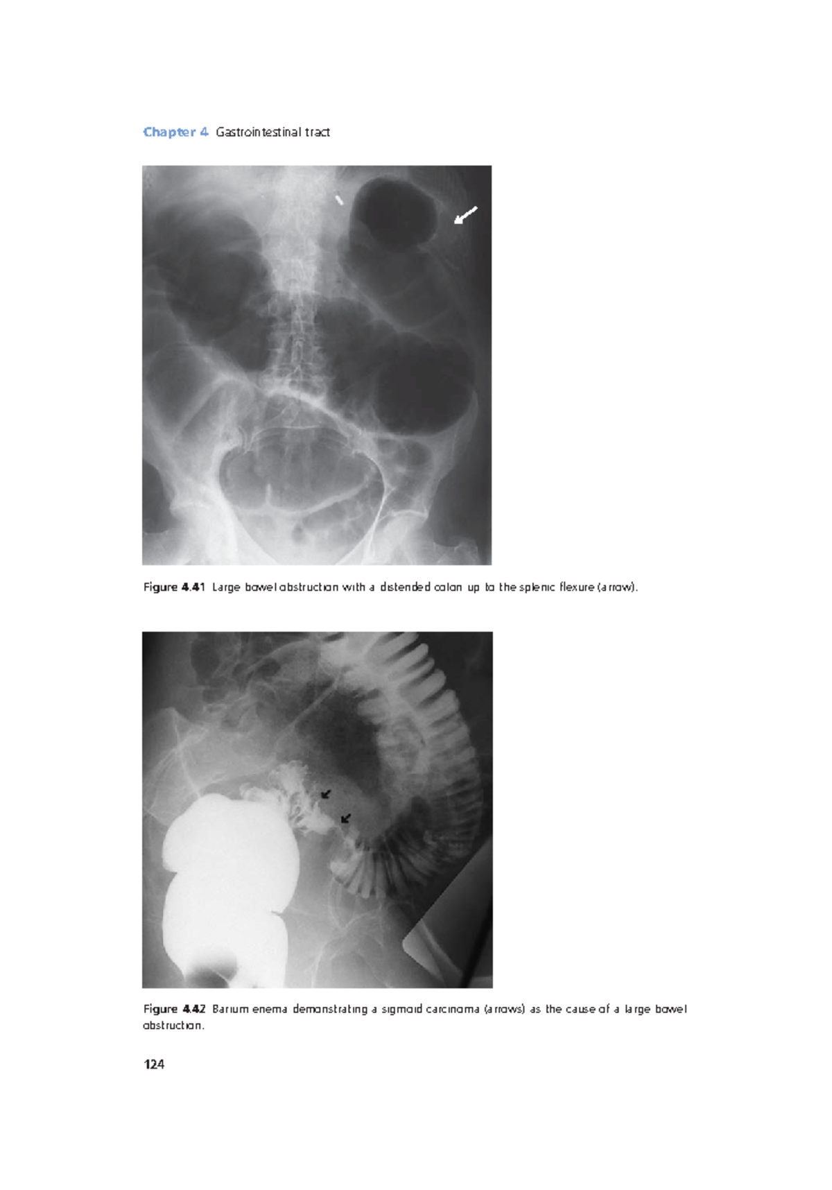 Radiology Lecture Notes pdf (42) - Chapter 4 Gastrointestinal tract 124 ...