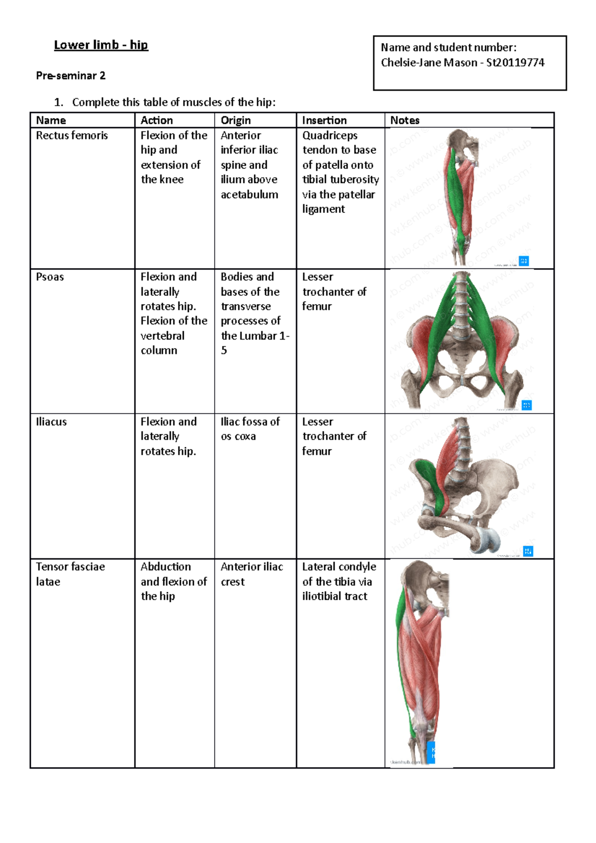 Hip2 - Anatomy of the hip - Lower limb - hip Pre-seminar 2 Complete ...