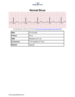 SBAR Code Blue - SBAR completed after the code blue simulation in adult ...