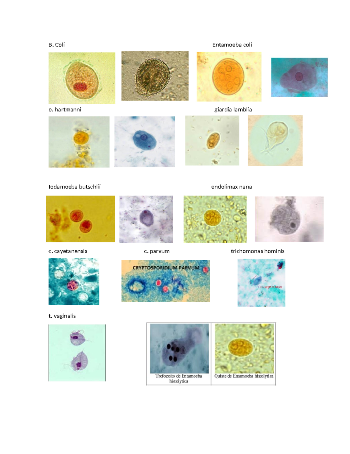 Entamoeba coli aaa - Parásitologia ll - B. Coli Entamoeba coli e ...