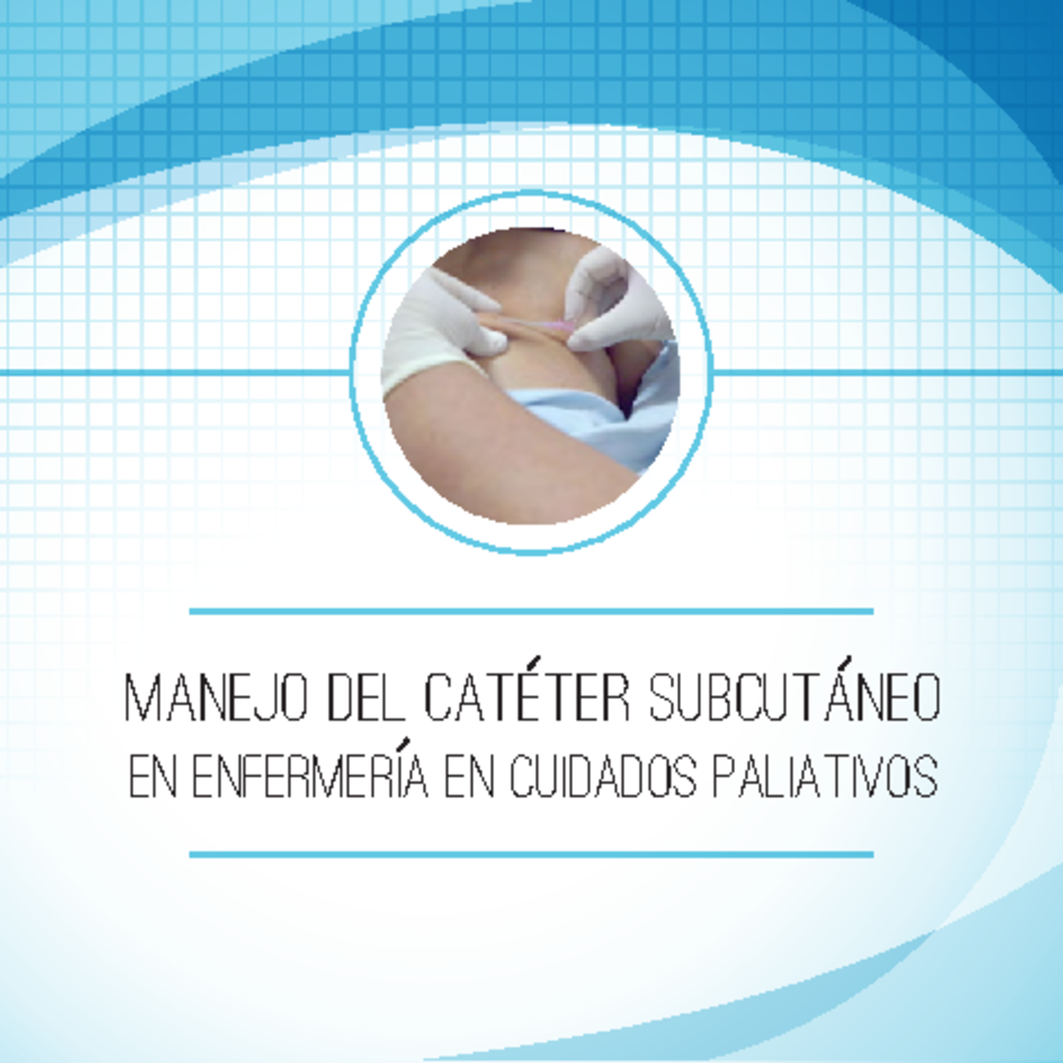 Manejo del Cateter subcutaneo en Enfermeria en Cuidados Paliativos ...