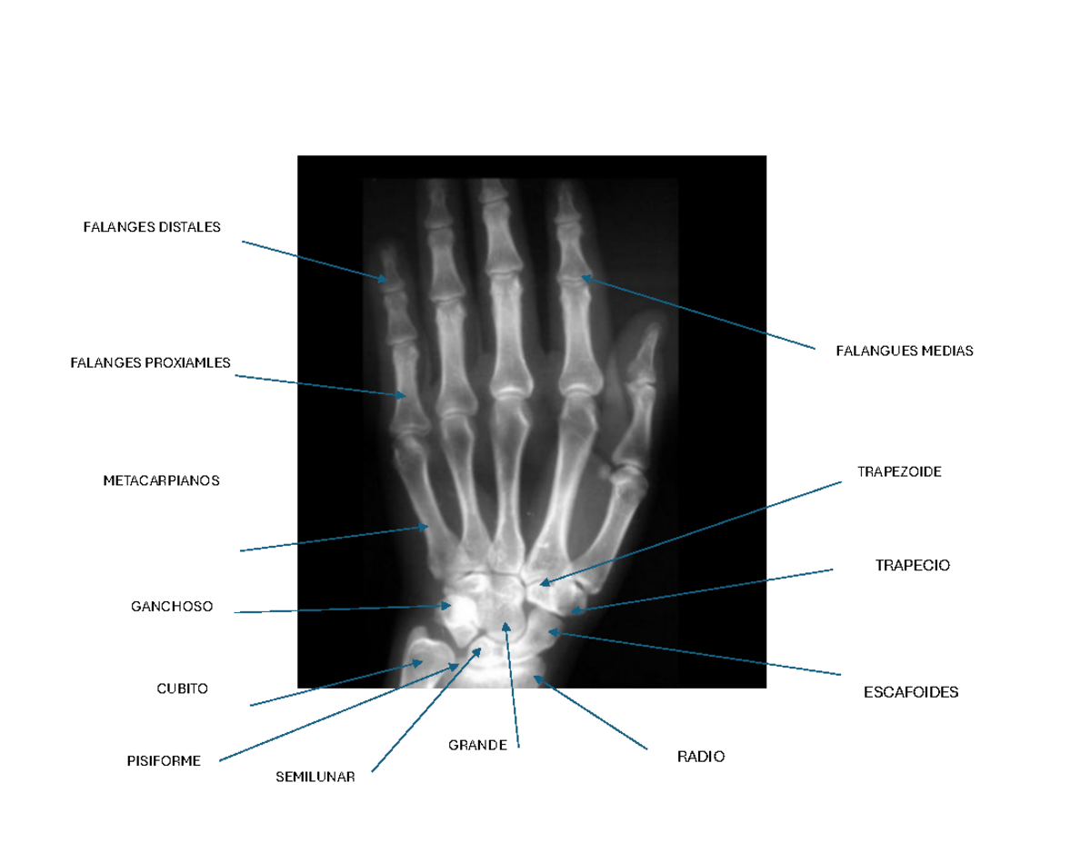 Radiografias - imagen - Estructura y función - FALANGES DISTALES ...