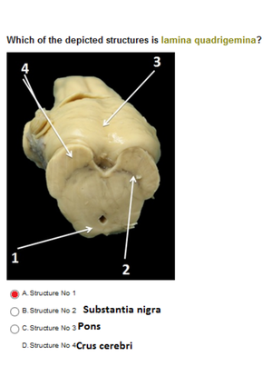 Fronto-parieto-occipital region - Topographic anatomy Dental Medicine ...