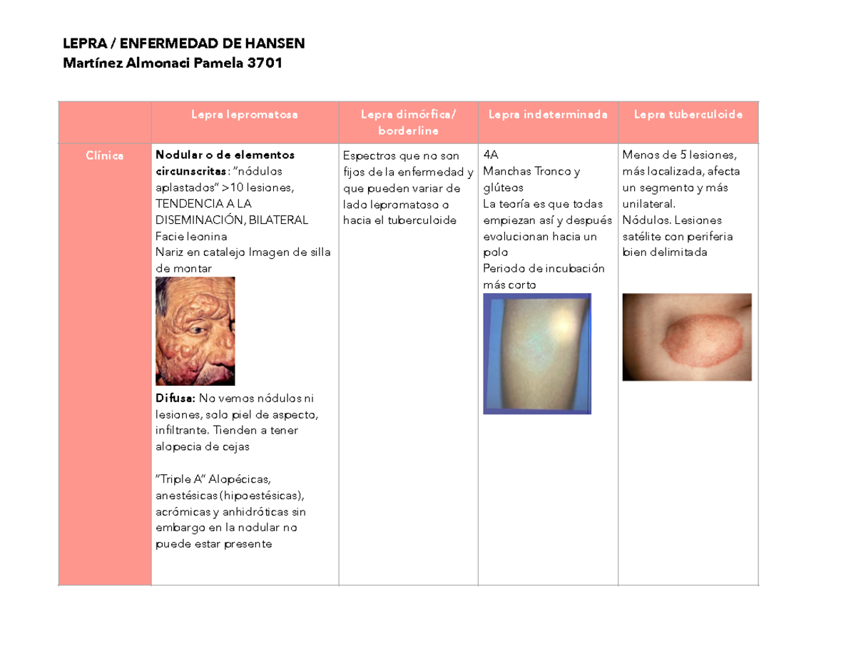 LEPRA CUADROS CLÍNICOS - Lepra lepromatosa Lepra dimórfica/ borderline ...