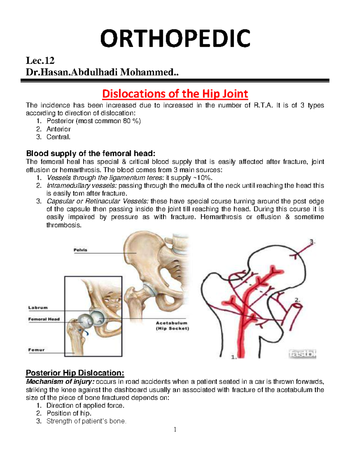Dislocations of the Hip Joint - ORTHOPEDIC Lec. Dr.Hasan Mohammed ...