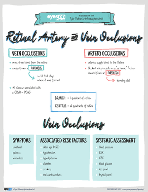 Visual Pathway & Visual Field Defects - THE VISUAL PATHWAY PRECHIASMAL ...