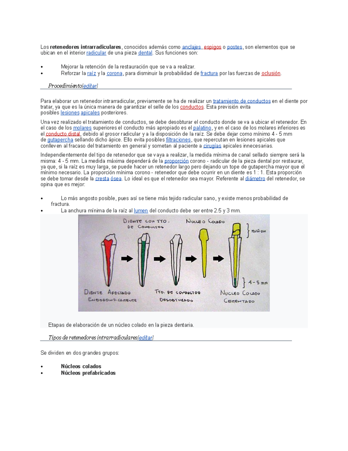Retenedores intrarradiculares, prótesis parcial fija - Los retenedores ...