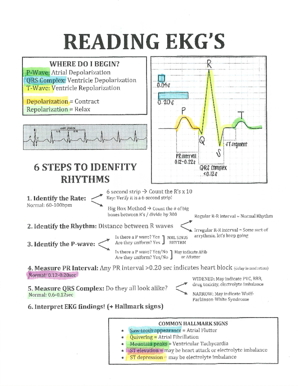 Reading EKGStudy Sheet - NURS223 - Studocu