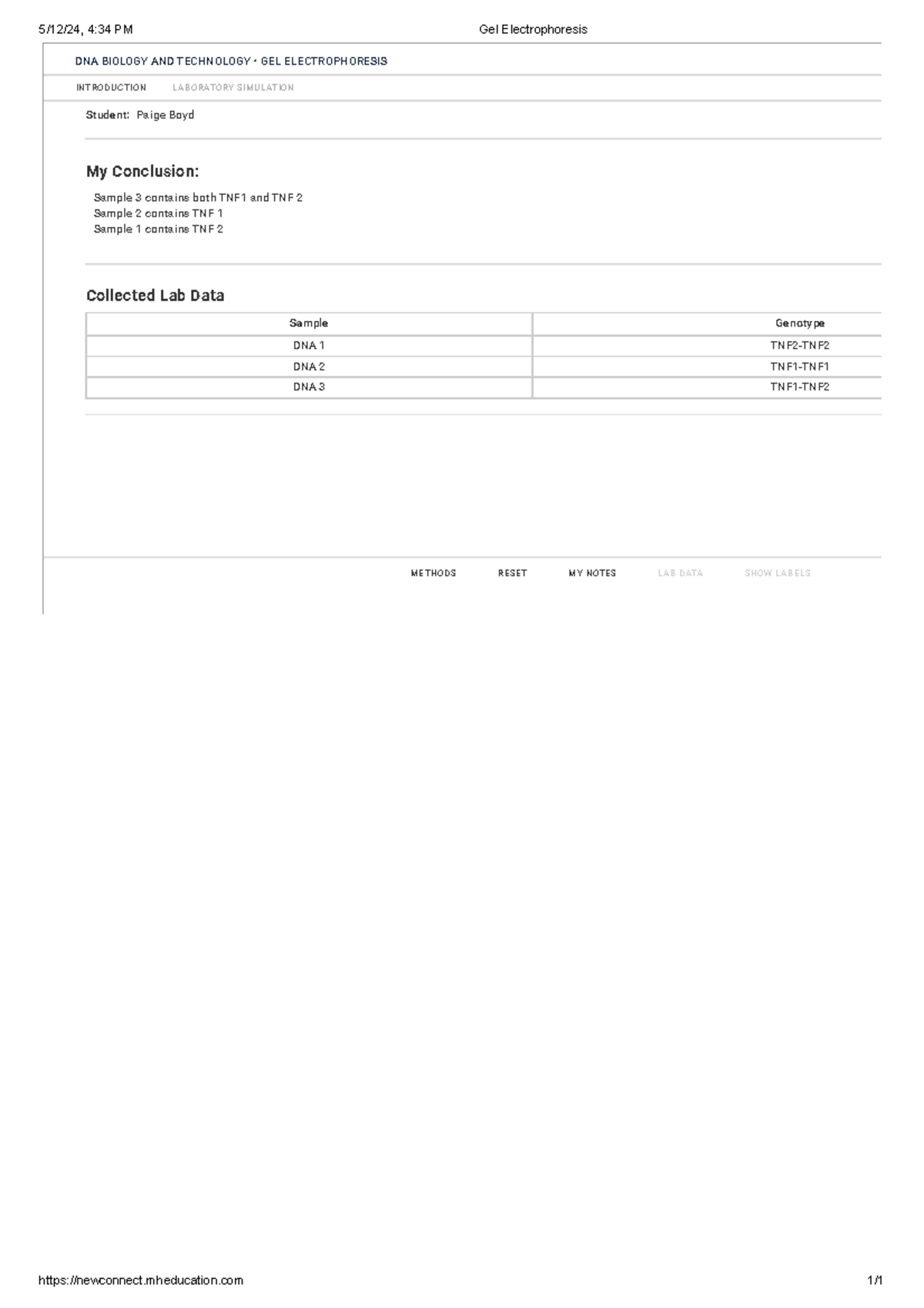 Gel Electrophoresis - This is a lab report - Medical biochemistry ...