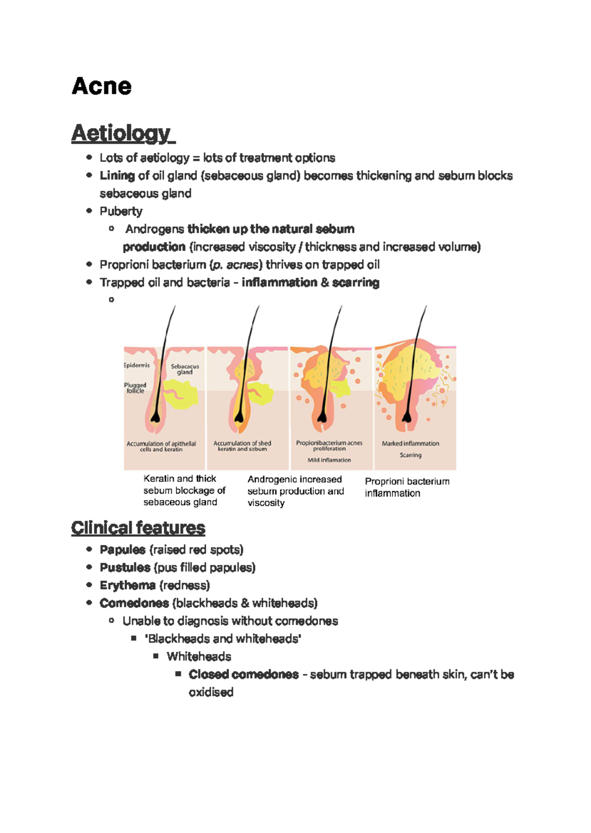 Acne - Acne - Ac n e Ae t i o l o g y Clinical features Lots of ...