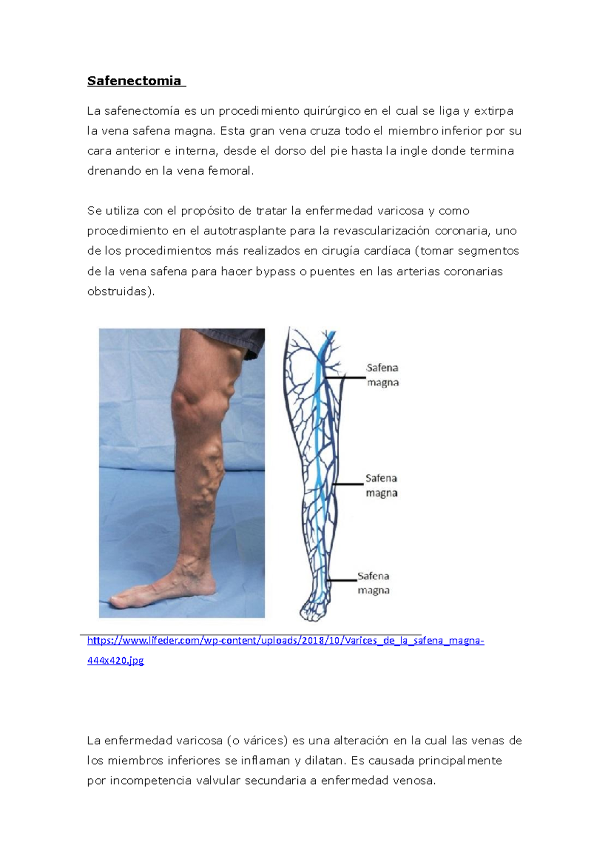 Safenectomia - DOCUMENTO INFORMATIVO, DOCUMENTO EDUCATIVO ...