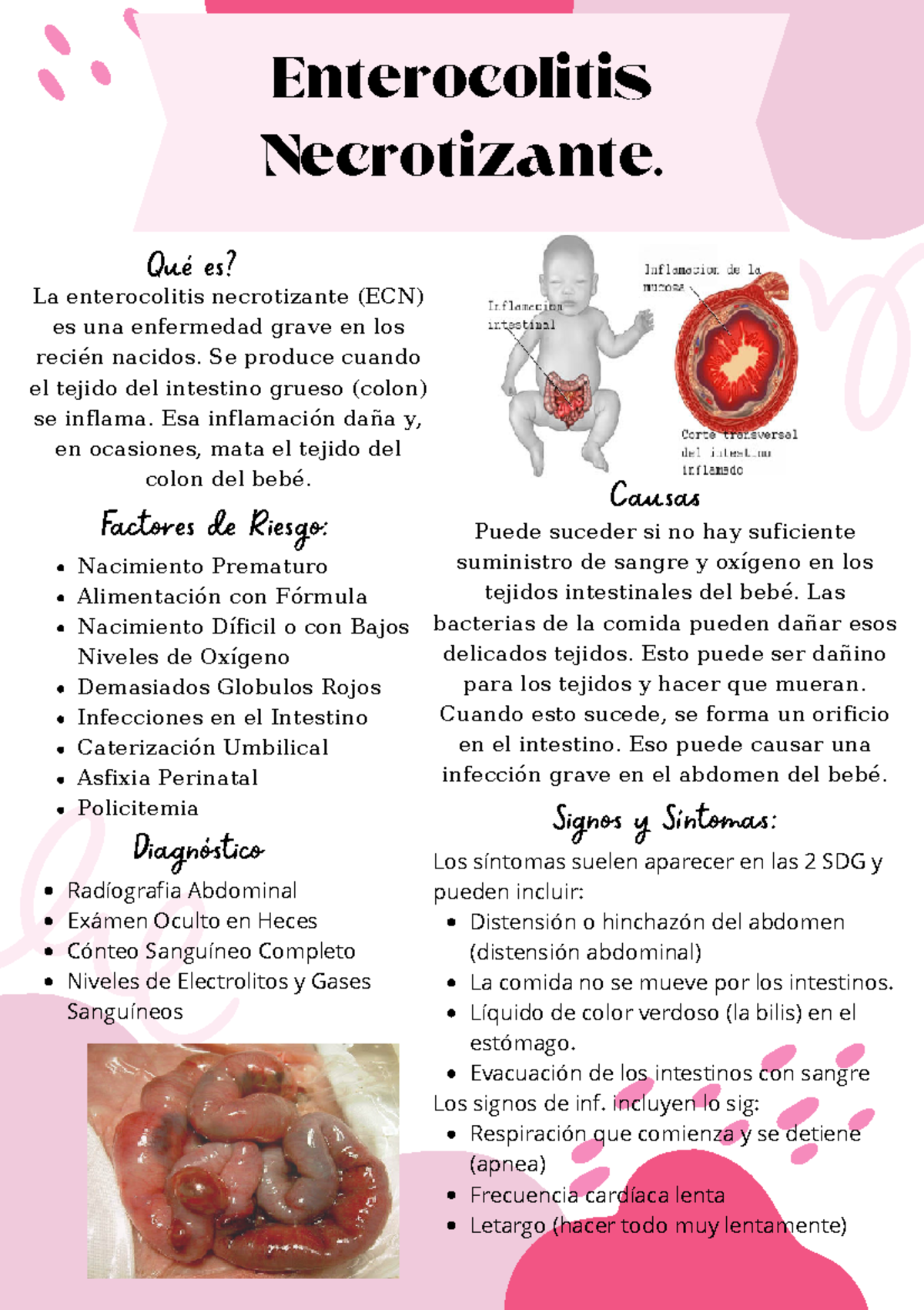 Enterocolitis Necrotizante - Qué es? La enterocolitis necrotizante (ECN ...