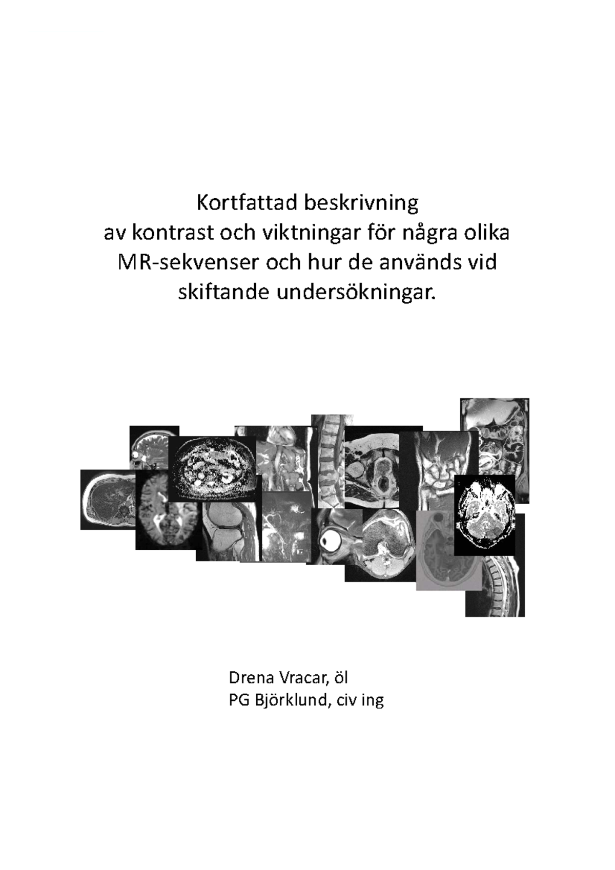 Kortfattad beskrivning av kontrast och viktningar för några olika MR ...