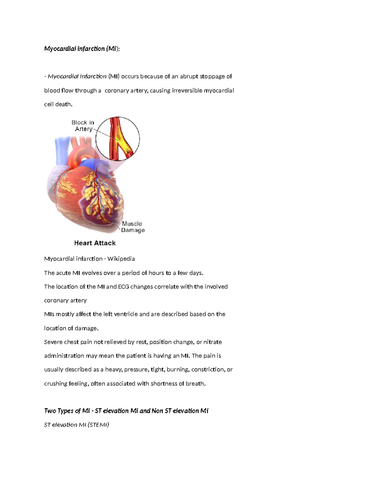 Myocardial Infarction - Myocardial infarction - Wikipedia The acute MI ...