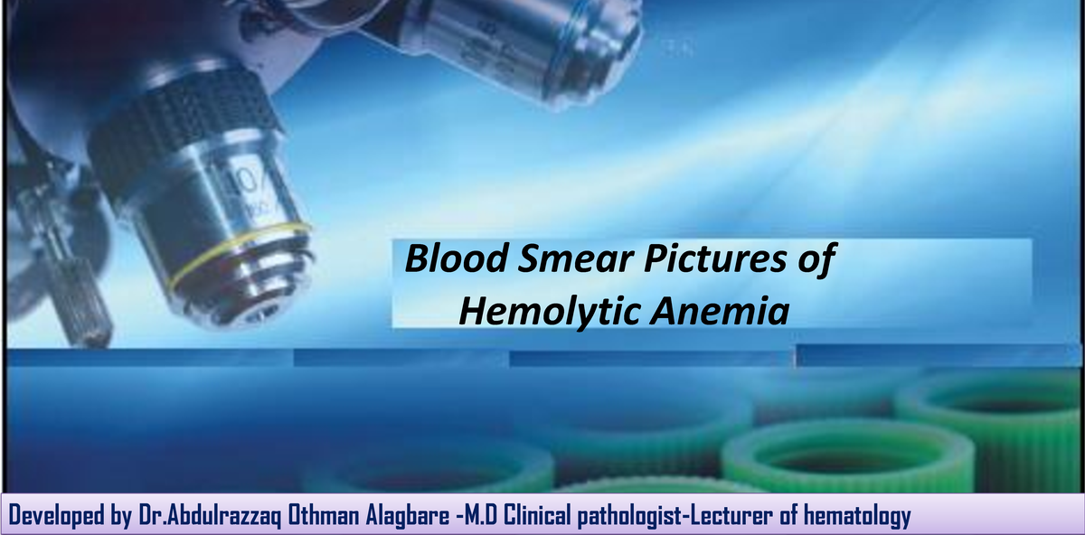 Hemolytic 24anemia د - Physiology - Blood Smear Pictures of Hemolytic ...