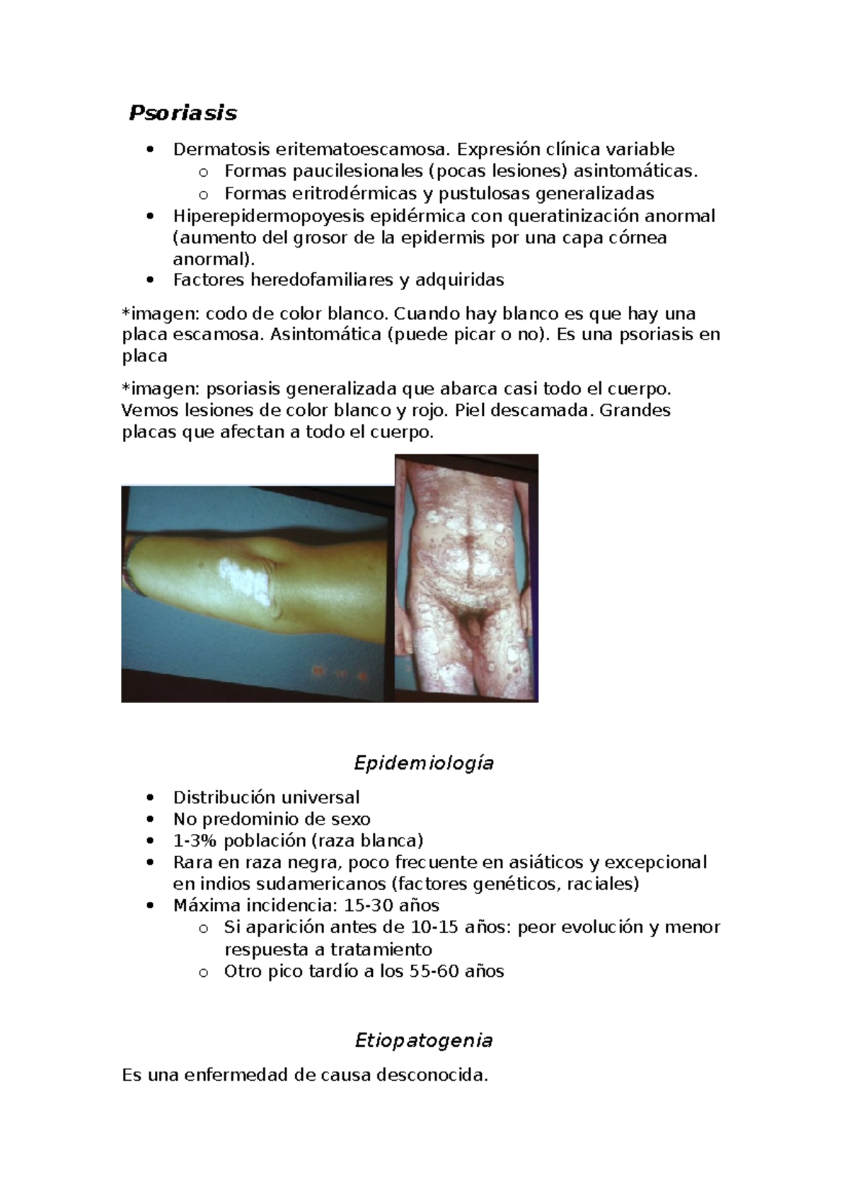 Psoriasis - resumen completo - Psoriasis Dermatosis eritematoescamosa ...