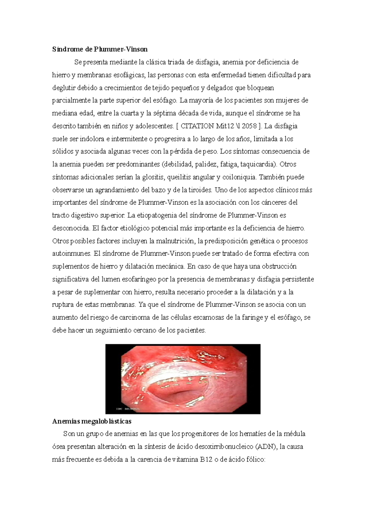 Síndrome de Plummer Medicina interna - Síndrome de Plummer-Vinson Se ...