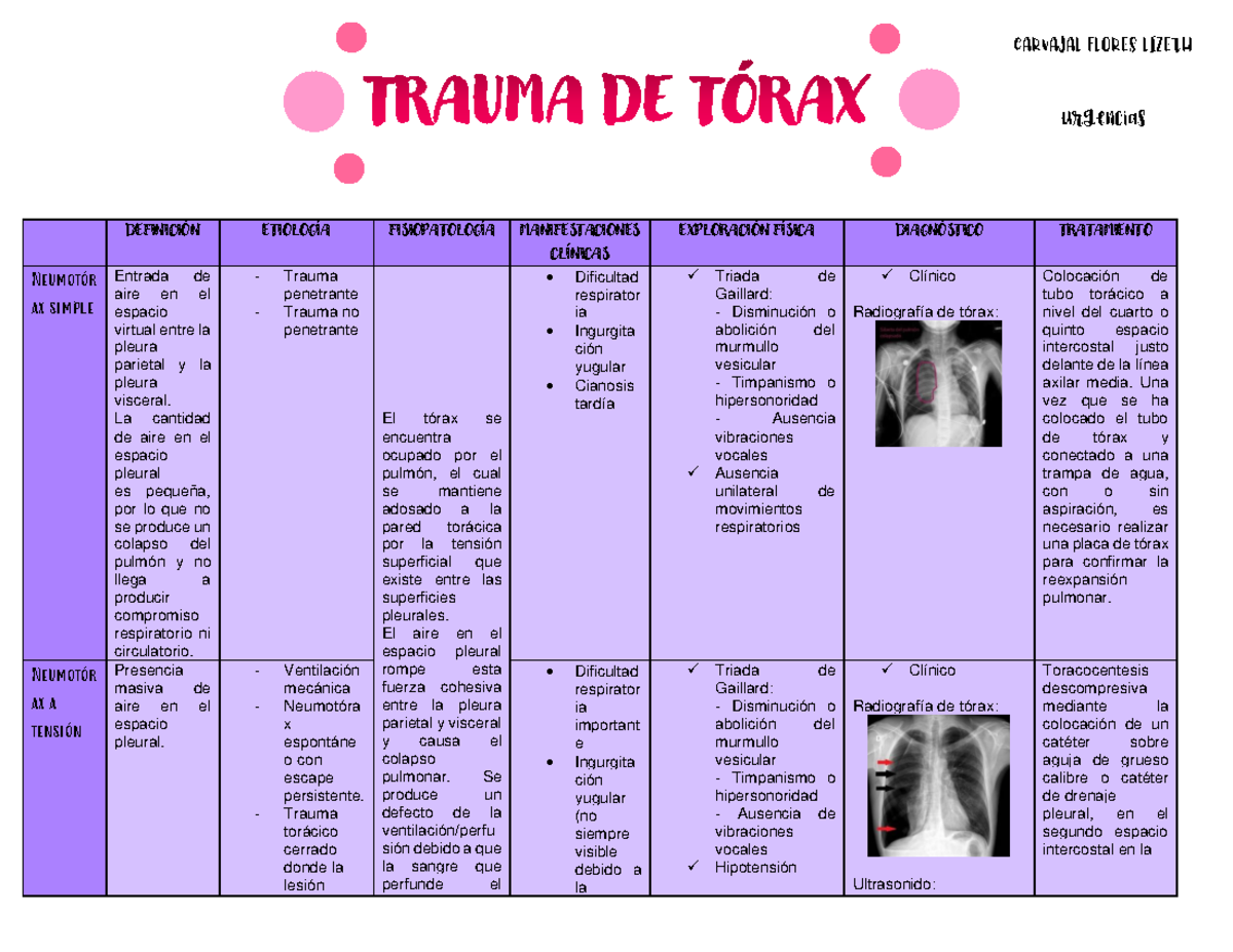 Cuadro comparativo - Trauma de Tórax - DEFINICI”N ETIOLOGÕA ...