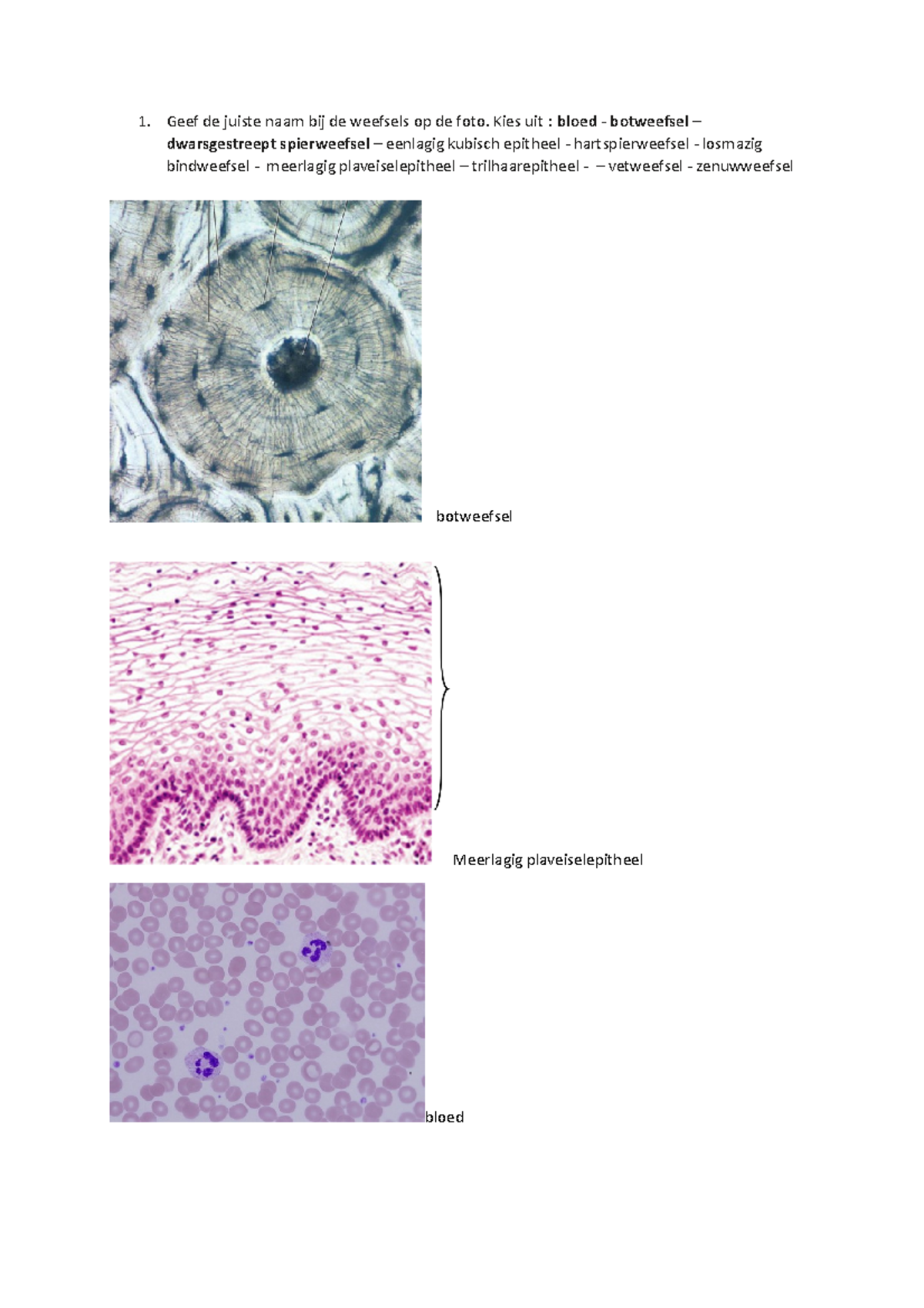 Oefeningen weefsels - Geef de juiste naam bij de weefsels op de foto ...