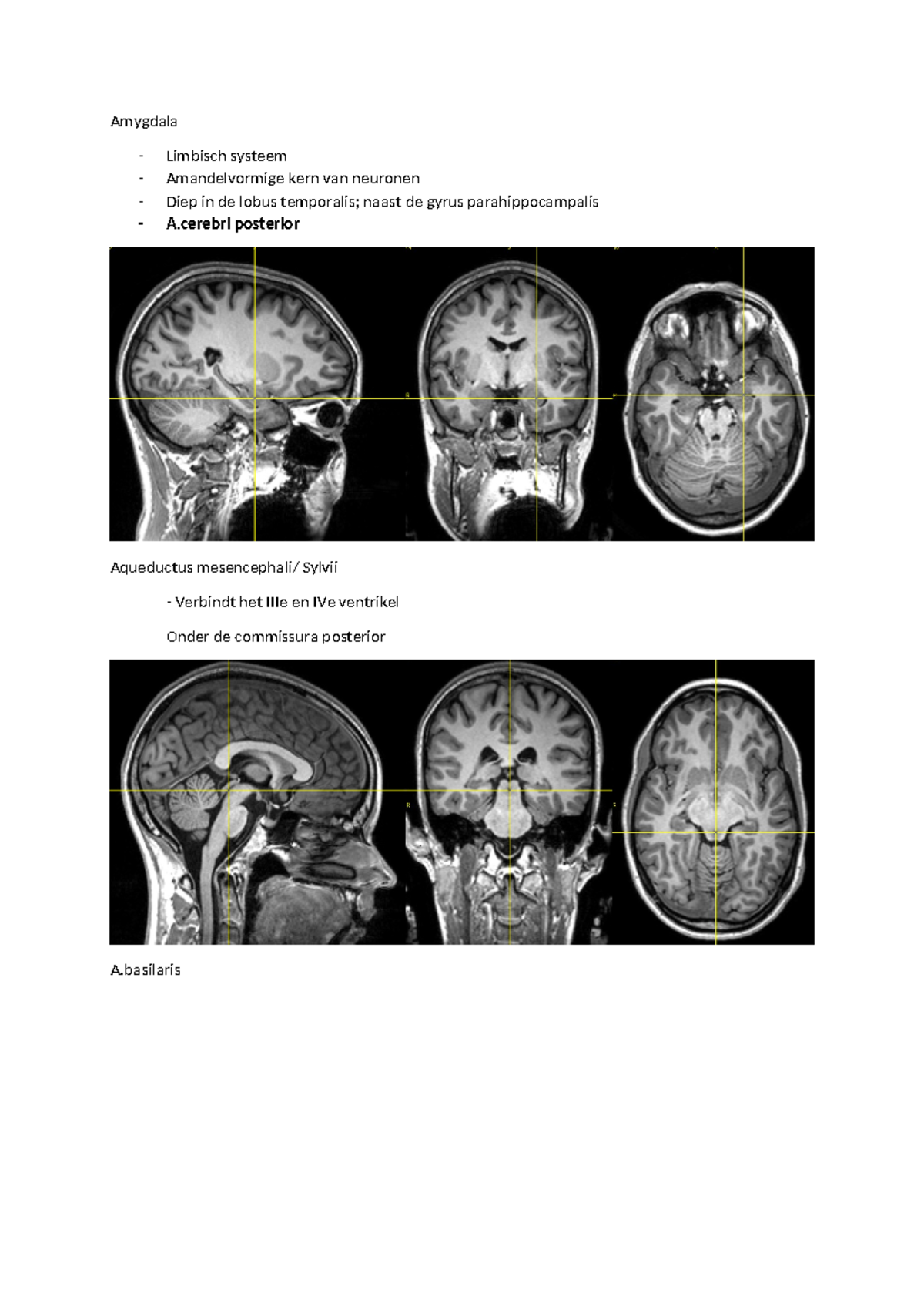 Cerego MRI 66-salient structures - Amygdala - Limbisch systeem ...