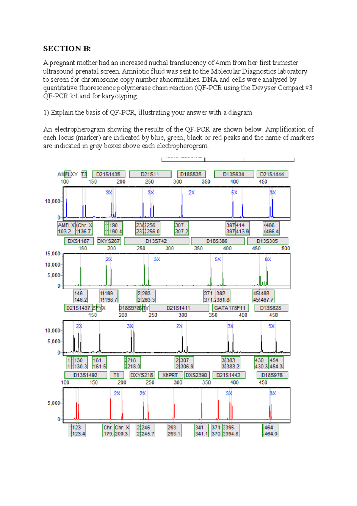 Example section B paper 2019 2020 - SECTION B: A pregnant mother had an ...
