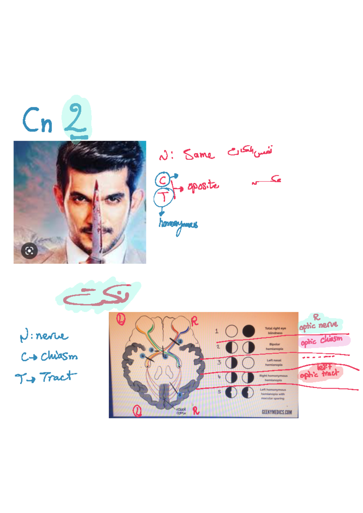 Optic n - Summary medicine - Studocu